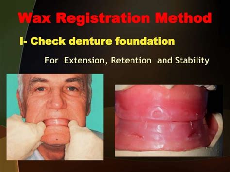 Clinical Steps For Complete Denture Construction 4 Steps Of Recording Jaw Relation E Centric