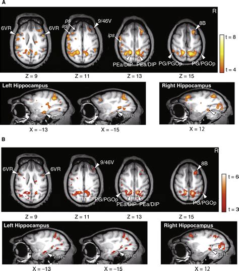 Functional Differentiation Of Memory Retrieval Network In Macaque Posterior Parietal Cortex Neuron