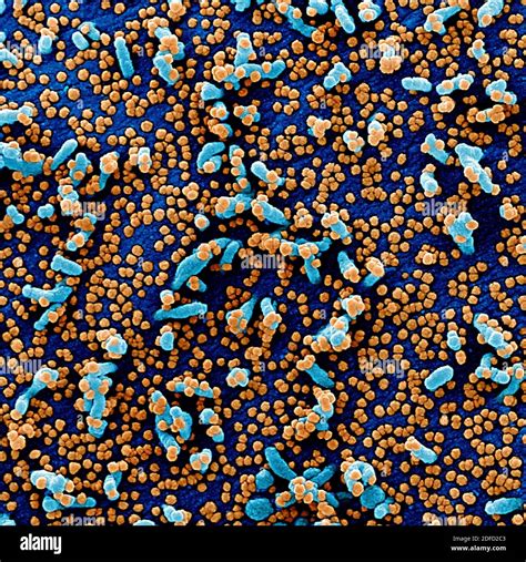 Colorized Scanning Electron Micrograph Of A Vero E6 Cell Blue Heavily Infected With Sars Cov 2