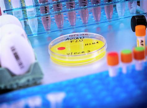 Concerning Bird Flu Mutation Found In Louisiana Patient