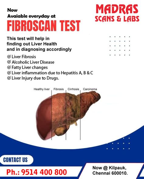 Liver Fibroscan In Chennai Madras Scans And Labs