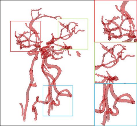 Medical Image Segmentation Results Tested In The Dataset Of The Download Scientific Diagram