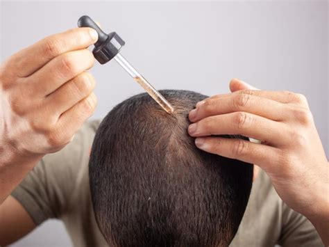 Regrowth From Minoxidil Regrow Your Hair With Potent Minoxidil