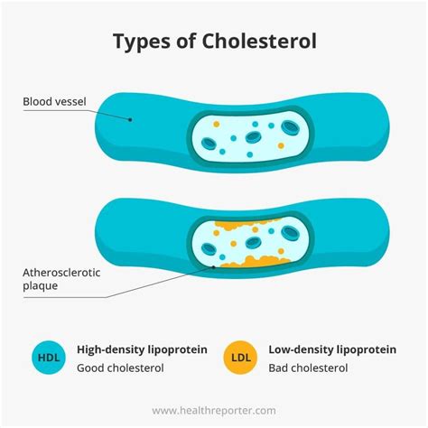 Total Cholesterol Levels