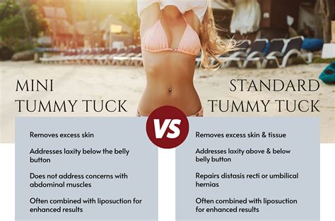 Tummy Tuck Mini Vs Standard Capizzi Md