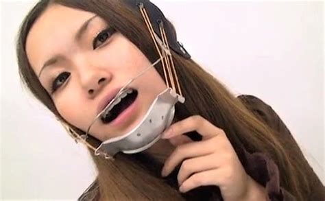 Pin By Metalmouthjoe Martin On Headgear Dental Braces Teeth Braces