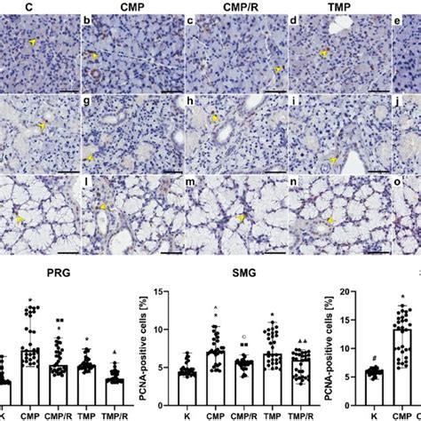 Effect Of Multidrug Immunosuppressive Protocols Based On Calcineurin