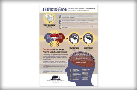 Concussion Poster Divergence Creative