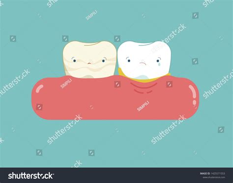 Calculus Teeth Cartoon Dental Concept Stock Illustration 1425571553