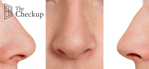 Right Under My Nose The Checkup