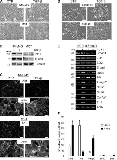 Figure 1 From Junb Contributes To Id2 Repression And The Epithelial Mesenchymal Transition In