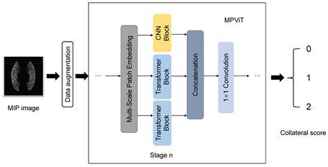 Automated Collateral Scoring On Ct Angiography Of Patients With Acute Ischemic Stroke Using