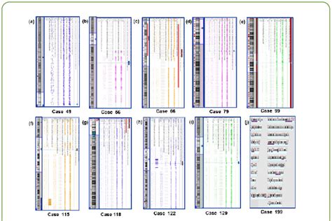 Pathogenic Genomic Imbalances Cytoscan 750k Microarray Profile A To Download Scientific