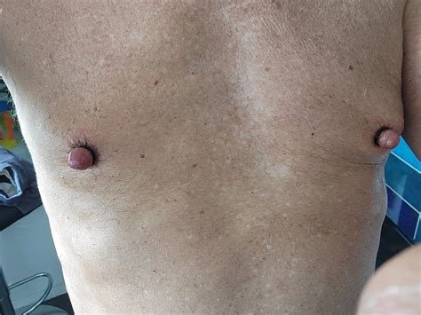 Nipple Pumping Nude Pics XHamster