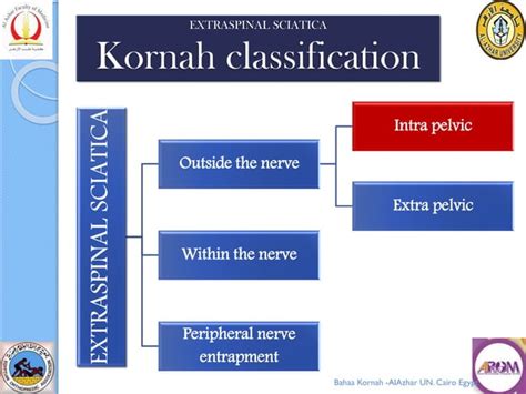 Extra Spinal Causes Of Sciatica And A Causes Algorithm Ppt