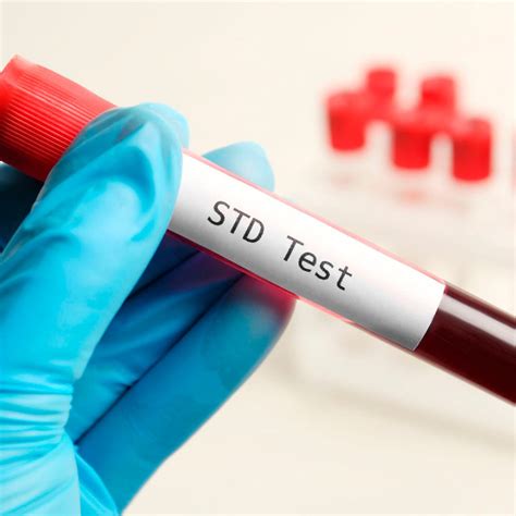 Std Testing Midtown Nyc And Rego Park Queens Std Screening In New York City