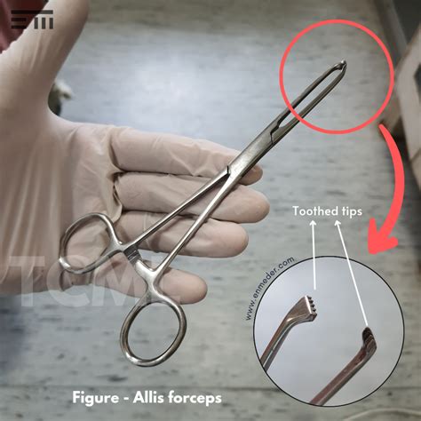 Allis Forceps Tcml The Charsi Of Medical Literature