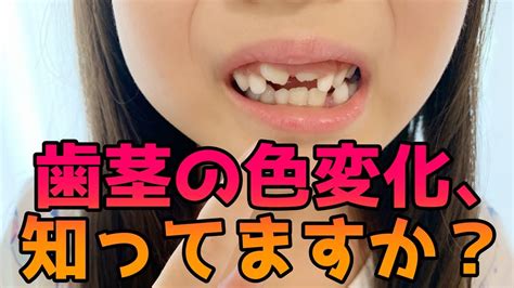 【小児歯科 解説】子どもの歯茎が黒い・茶色い原因と対策！親必見の口腔ケア完全ガイド Youtube
