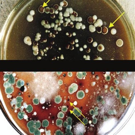 PDF Environmental Prevalence Of Cryptococcus Neoformans And Cryptococcus Gattii In India An