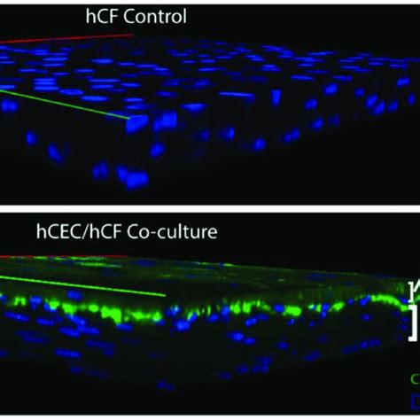 Fibronectin Cfn Expression In Hcf Stromal Constructs And