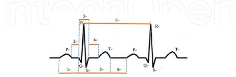 Figure 1 From Electrocardiogram Recognization Based On Variational Autoencoder Semantic Scholar