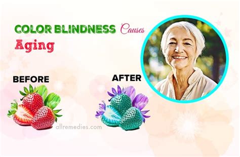 List Of 13 Common Color Blindness Causes Symptoms And Effects