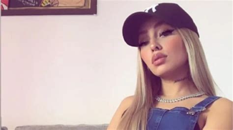 Tamara Báez La Novia De L Gante Se Hizo Un Retoque Estético En La Cara Y Mostró Los Resultados