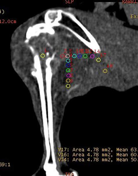 Monochromatic Sagittal Multiplanar Reconstruction Mpr Enhanced Image