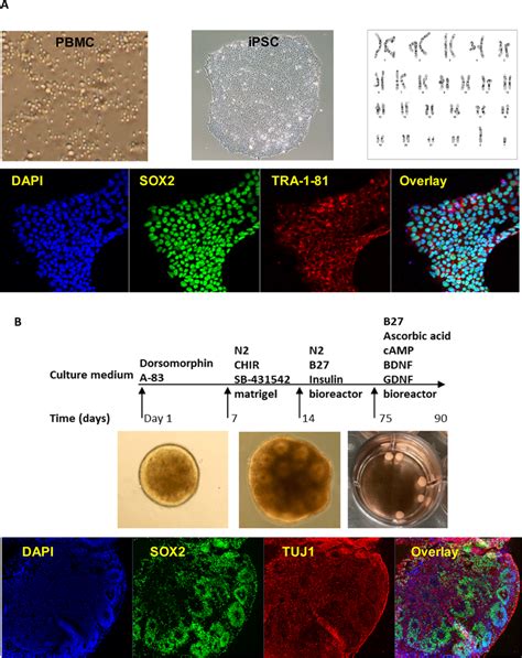Generation Of Ipsc Derived Forebrain Organoids A Ipsc Generation Using Download Scientific
