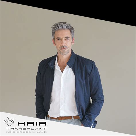 Hair Transplant 💁‍♂Διάγνωση To πρώτο βήμα για να απαλλαγείτε απο την τριχόπτωση 👉Όταν γίνεται