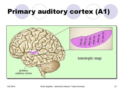 Primary Auditory Cortex