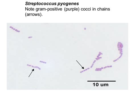 Antibiotics For Strep Pyogenes