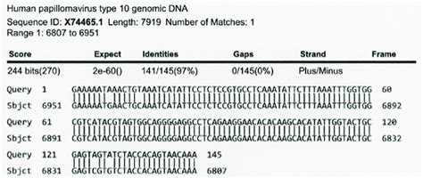 National Center For Biotechnology Informationebasic Local Alignment