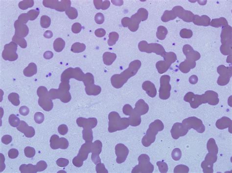 Rouleaux Cells