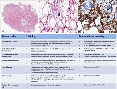 Mesenchymal Tumor With Myxoid And Lipomatous Components Containing Download Scientific Diagram