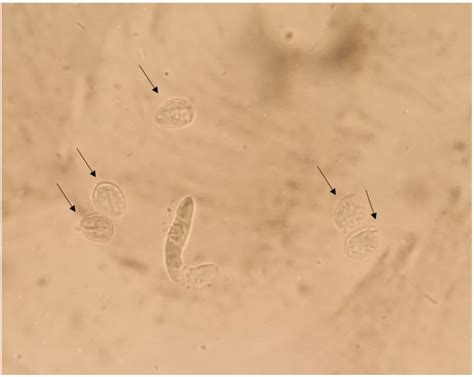 Giardia Spp Cysts Arrows Fecal Flotation Magnification X100 Download Scientific Diagram