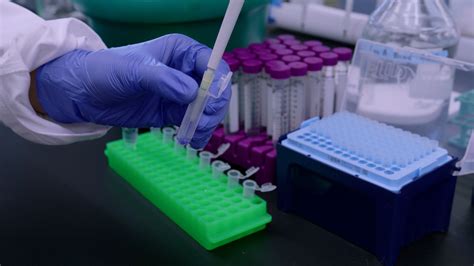 Concanavalin A Based Sedimentation Assay To Measure Substrate Binding Of Glucan Phosphatases