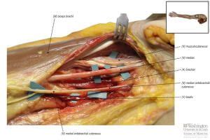 Median Nerve Peripheral Nerve Surgery Washington University In St Louis