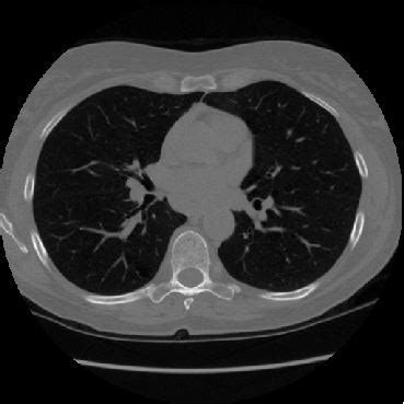 Why Gray To BGR Conversion Giving Distorted Results OpenCV Q A Forum