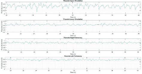 Unfiltered Flow Waveform For 3 Mm Ijs Experiment Download Scientific