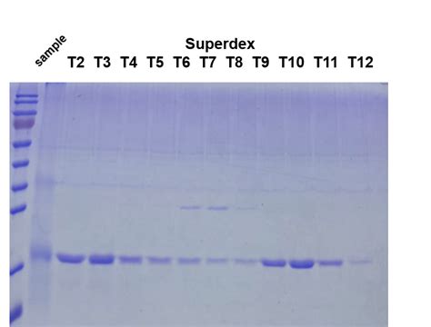 How To Avoid Soluble Aggregate During Protein Purification Researchgate