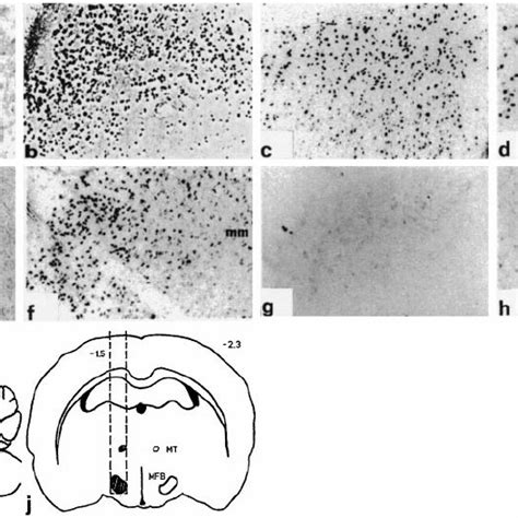 Immunodetection Of C Jun N Terminal Phosphorylation In The Adult Rat Download Scientific