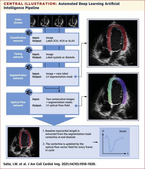 Artificial Intelligence For Automatic Measurement Of Left Ventricular Strain In Echocardiography