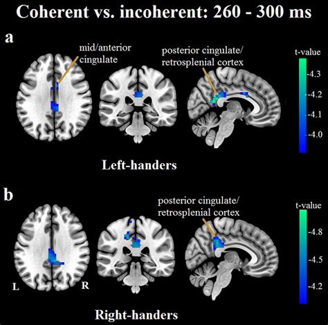 visualisation of results from source localization analyses contrasting download scientific