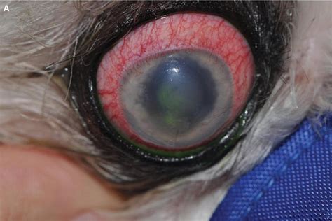 Ciliary Flush Vs Conjunctivitis