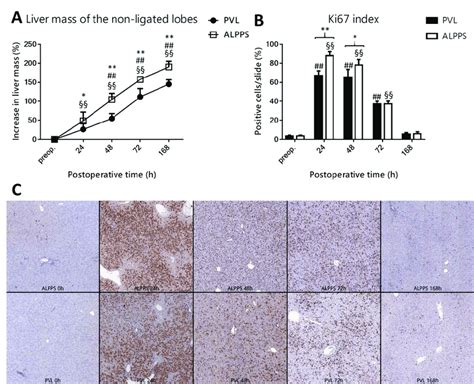 Effect Of Portal Vein Ligation Pvl And Associating Liver Partition Download Scientific