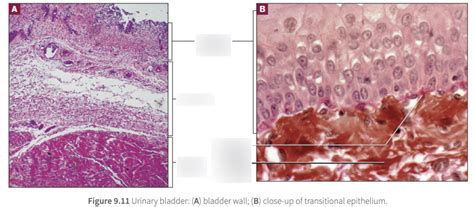 Urinary Bladder Wall And Close Up Of Transitional Epithelium Diagram
