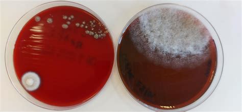 Contaminated Agar R Microbiology