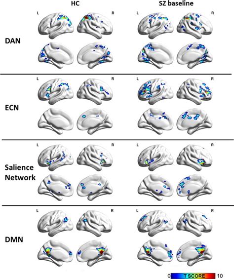 Resting State Networks In Healthy Controls Hc N 33 Left Column And Download Scientific