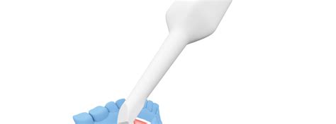 Optically Capturing Jaw And Tooth Geometry Balluff